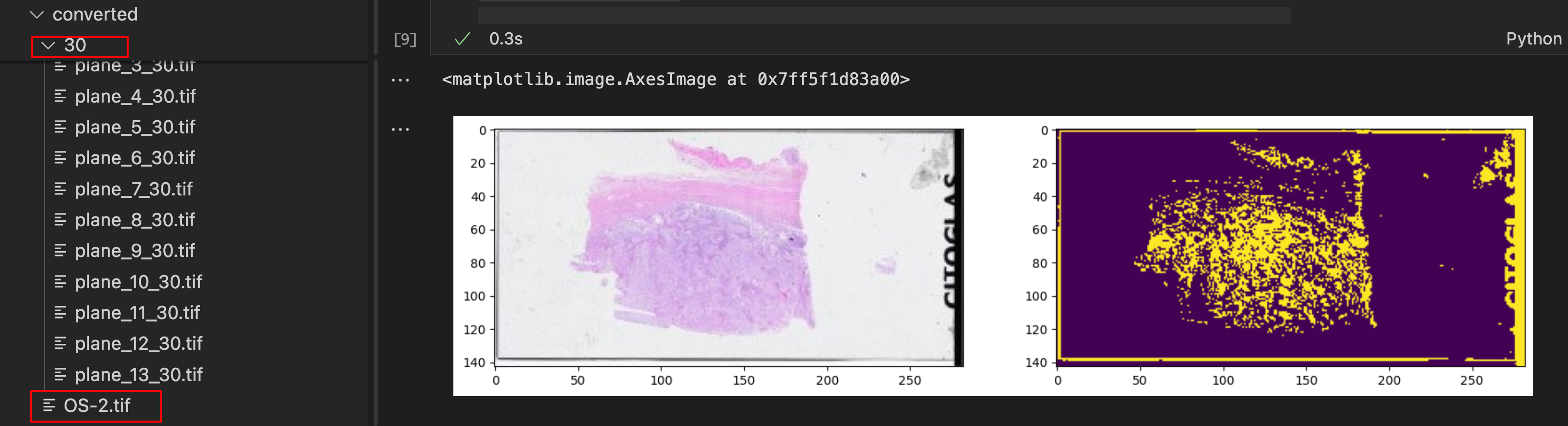 数字病理格式转换｜vsi格式转为tif格式的方法-CSDN博客