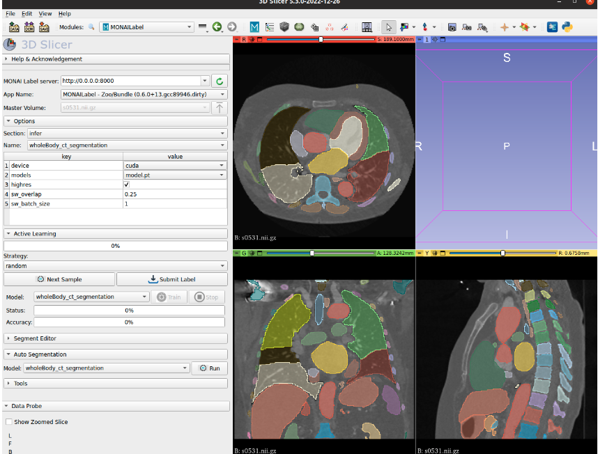 CT全身104个器官分割-在3D Slicer中使用 Monai Bundle 和 Model Zoo 标注医学影像数据_monai ...