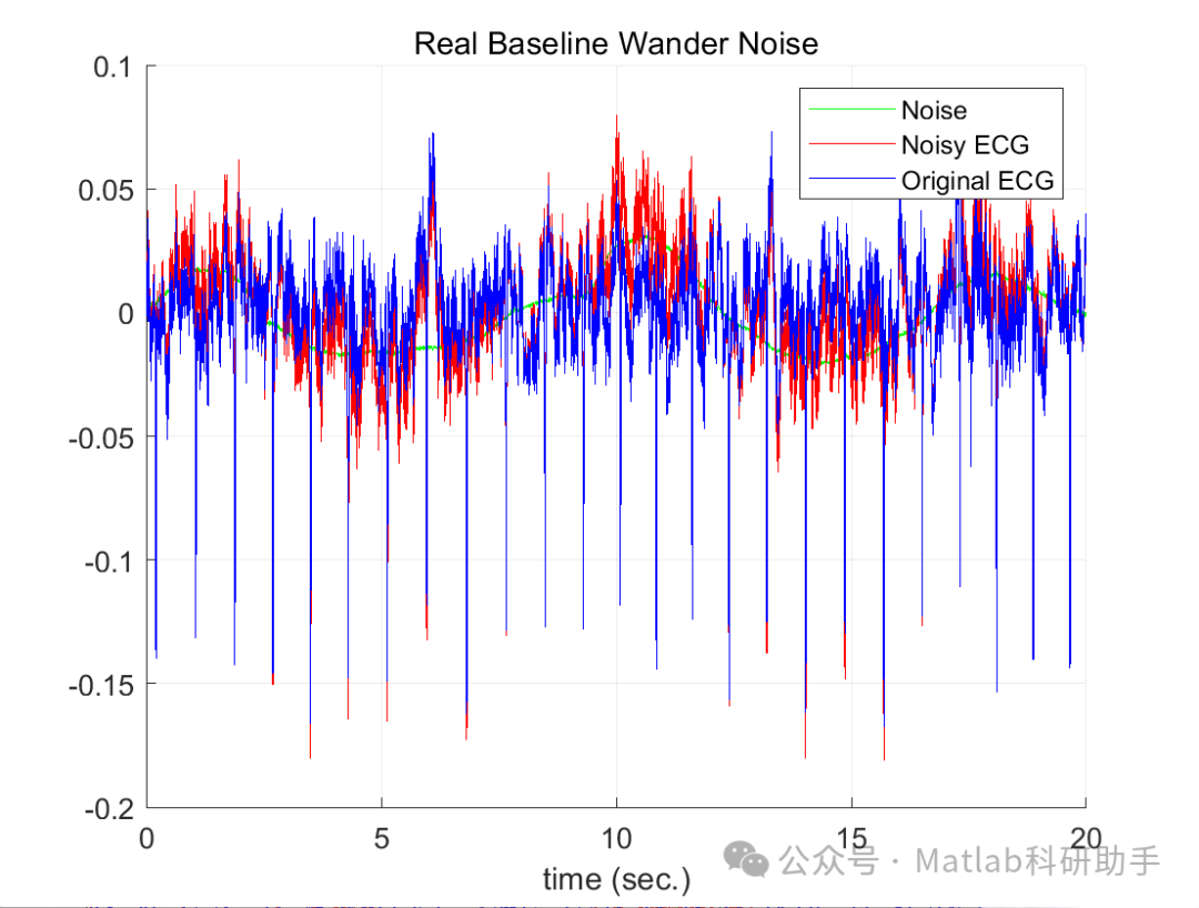 【ECG信号处理】包括基本波检测、信号去噪、信号重建度量附Matlab代码_心电信号snr-CSDN博客