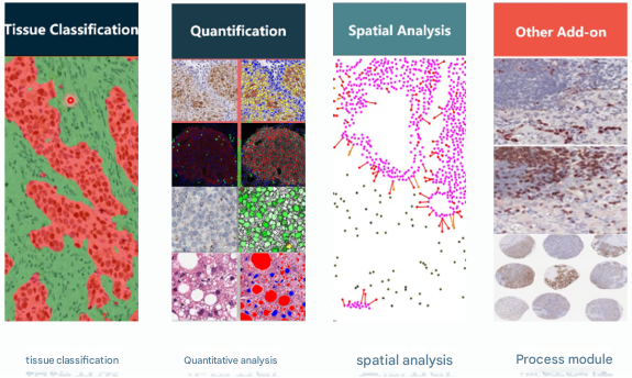 Abics Multicolor Analysis Service - HALO Pathology Image Analysis-CSDN博客