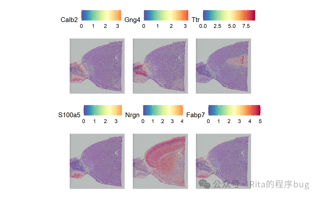 空间转录组|找marker基因&细分解剖区域&处理多切片_空间转录组 代码-CSDN博客