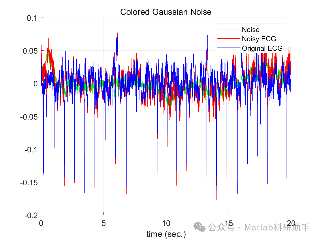【ECG信号处理】包括基本波检测、信号去噪、信号重建度量附Matlab代码_雷达重建心电-CSDN博客