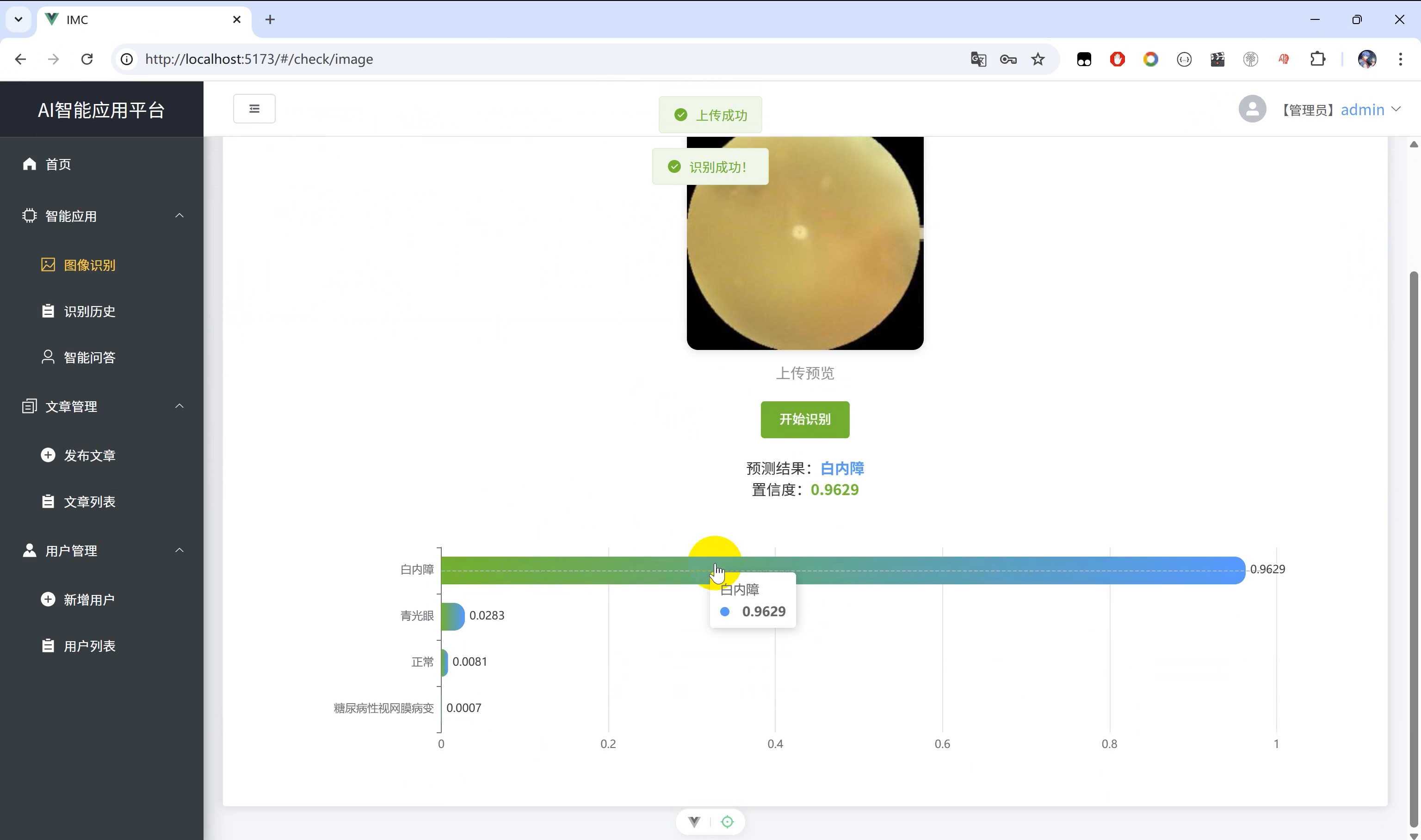 眼疾识别系统【最新版】Python+TensorFlow+Vue3+Django+人工智能+深度学习+卷积神经网络算法-CSDN博客