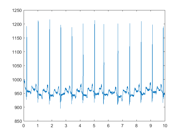 【ECG心电信号】基于HHTransform分析心电图信号附Matlab代码-CSDN博客