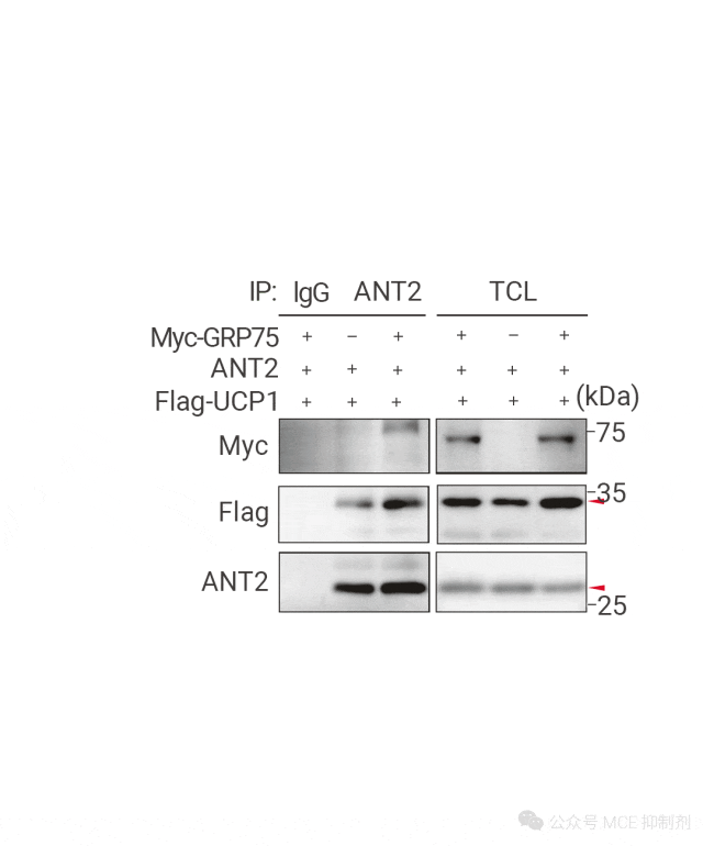 Co-IP 实验不踩坑：蛋白 “拉下场“ 的秘密！揭秘Co-IP实验操作技巧_ha磁珠做ip时igg用什么属性-CSDN博客