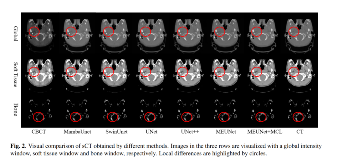 Mamba助力UNet！高效分割即可轻松实现！_mm-unet nn-unet-CSDN博客