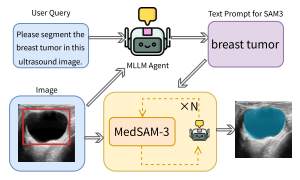 MedSAM-3：让多模态医学影像进入“概念分割时代”-CSDN博客