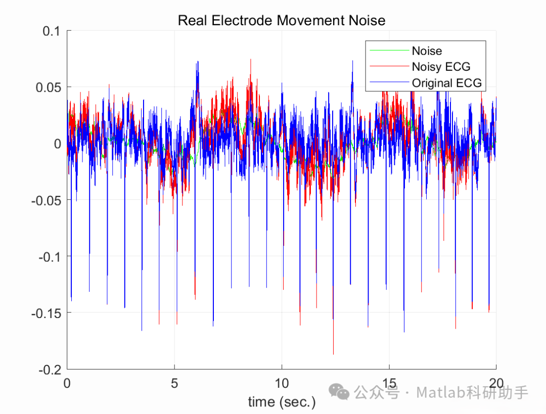 【ECG信号处理】包括基本波检测、信号去噪、信号重建度量附Matlab代码_心电信号snr-CSDN博客