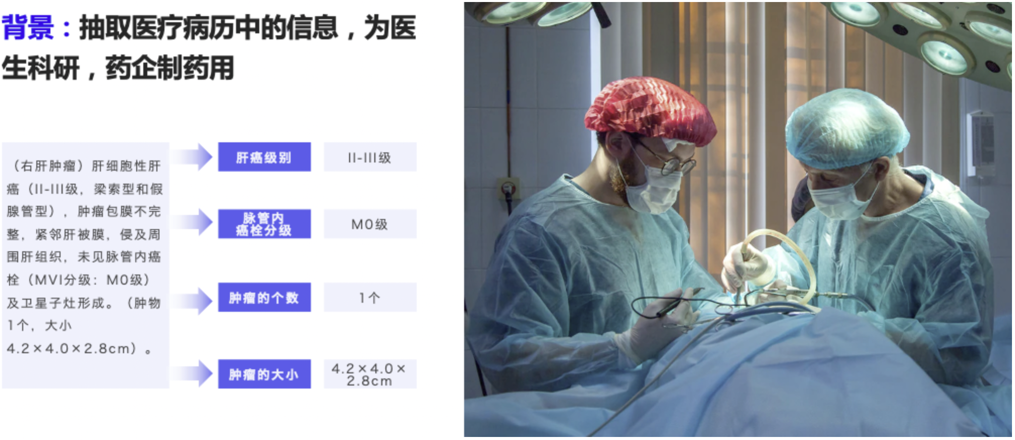 了解UIE模型-CSDN博客