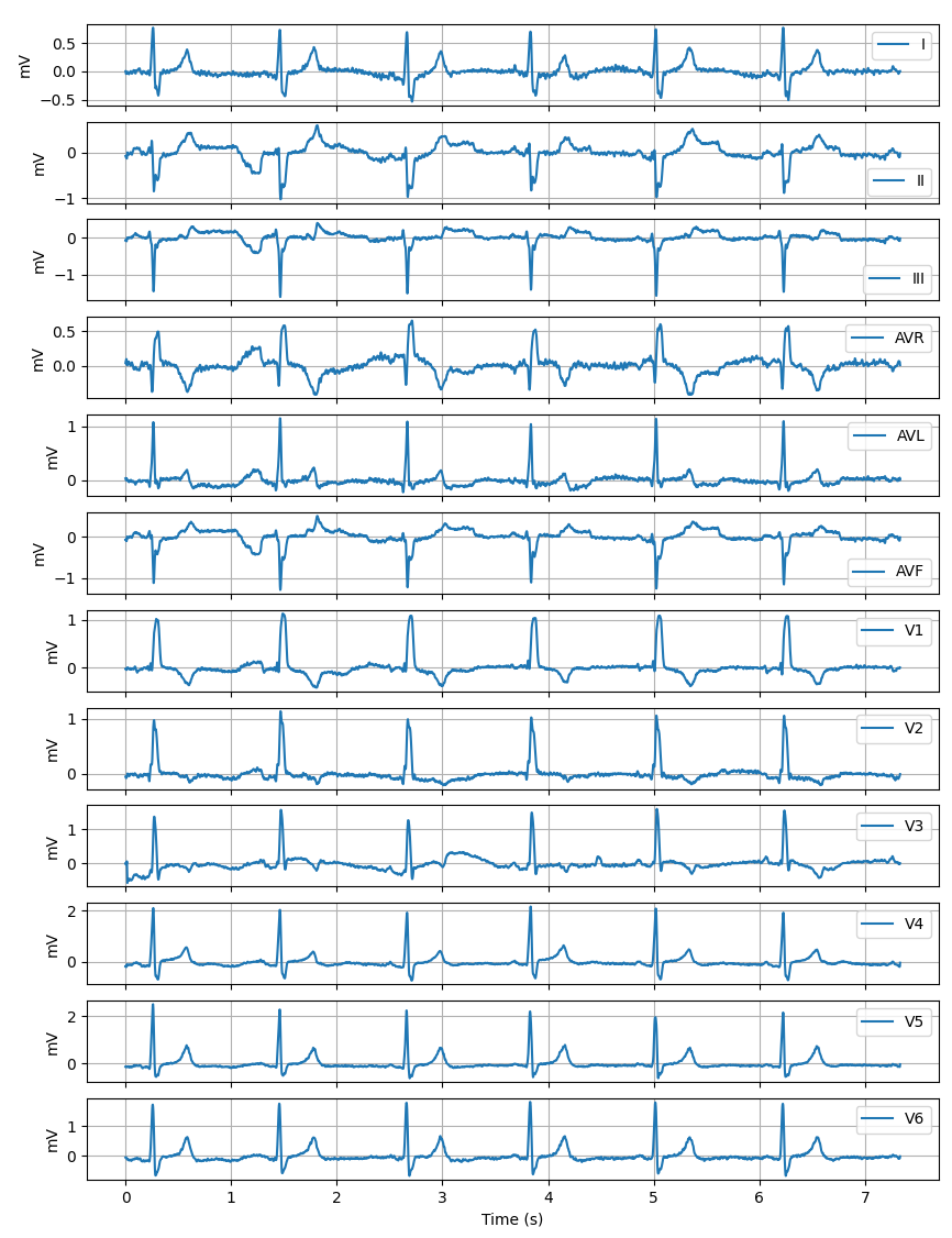 【MIMIC数据库教程】八、使用Python读取心电信号并绘制_mimic-iv-ecg-CSDN博客