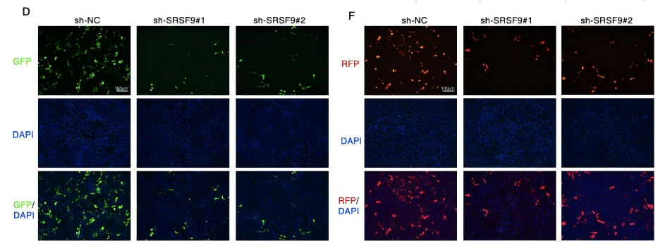 【技术应用】EGFP/RFP-minigene可视化揭示SLC37A4的可变剪接机制-CSDN博客