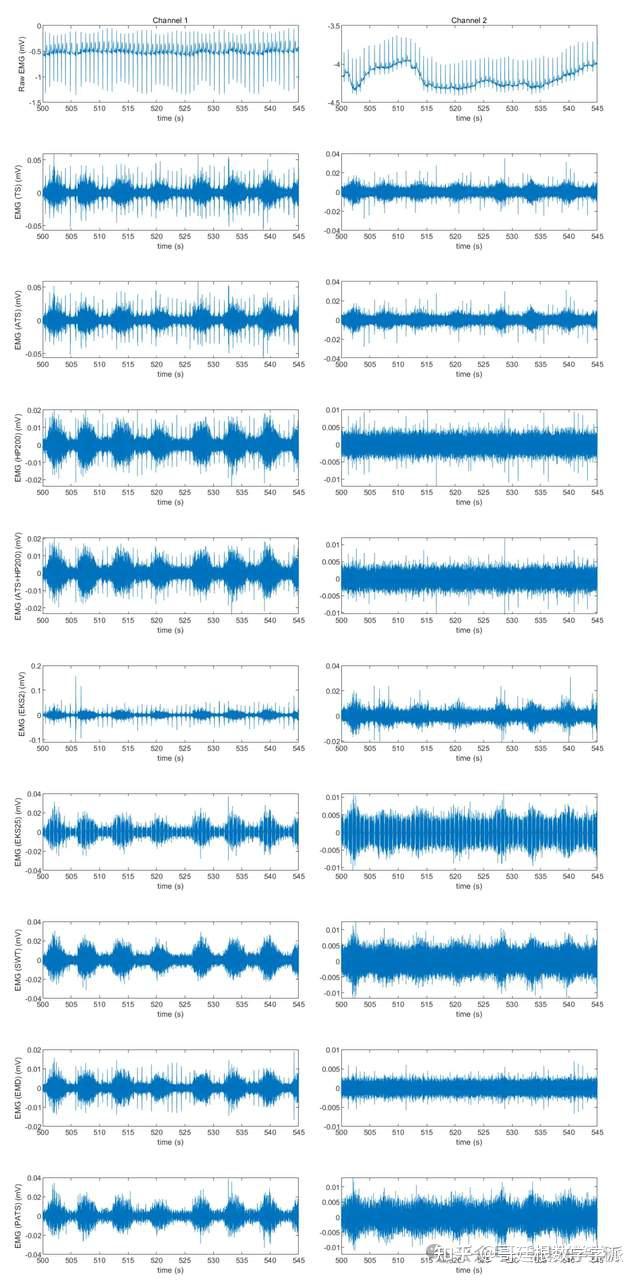几种心电信号ECG降噪方法（Python）_ecg信号滤除50hz的python代码-CSDN博客