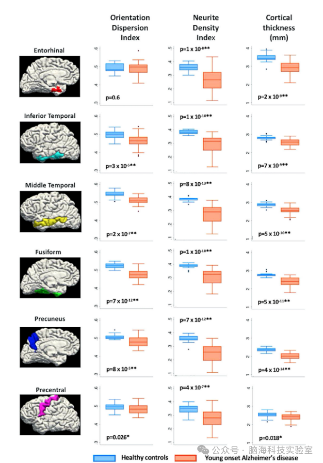 J. Magn. Reson. Imaging:来自弥散成像的退行性脑疾病的MR生物标志（研究综述）_双室张量模型-CSDN博客