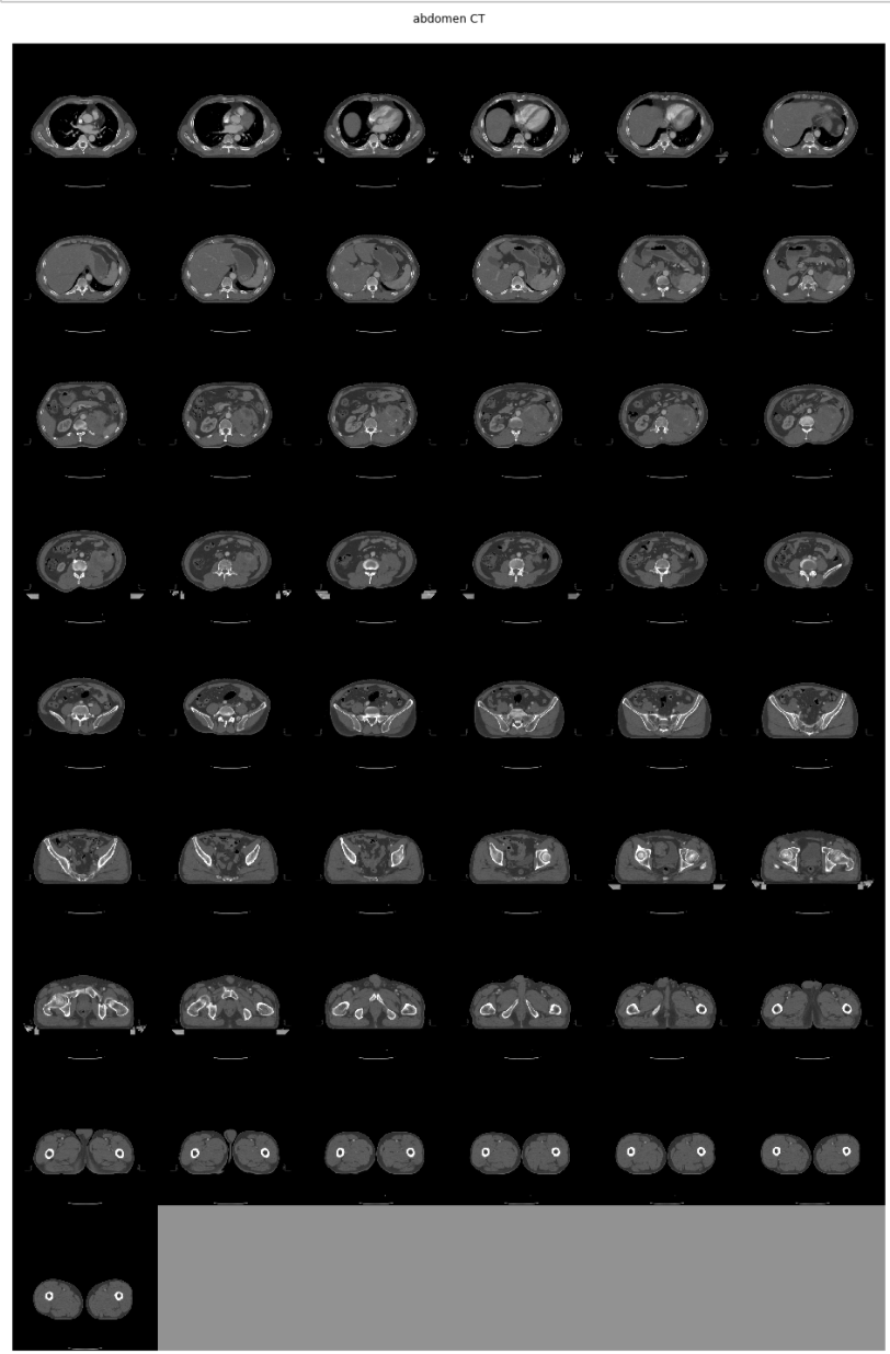 如何用python显示3D医学图像？MONAI这个功能太好用~_python monai-CSDN博客