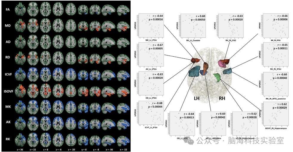 J. Magn. Reson. Imaging:来自弥散成像的退行性脑疾病的MR生物标志（研究综述）_双室张量模型-CSDN博客