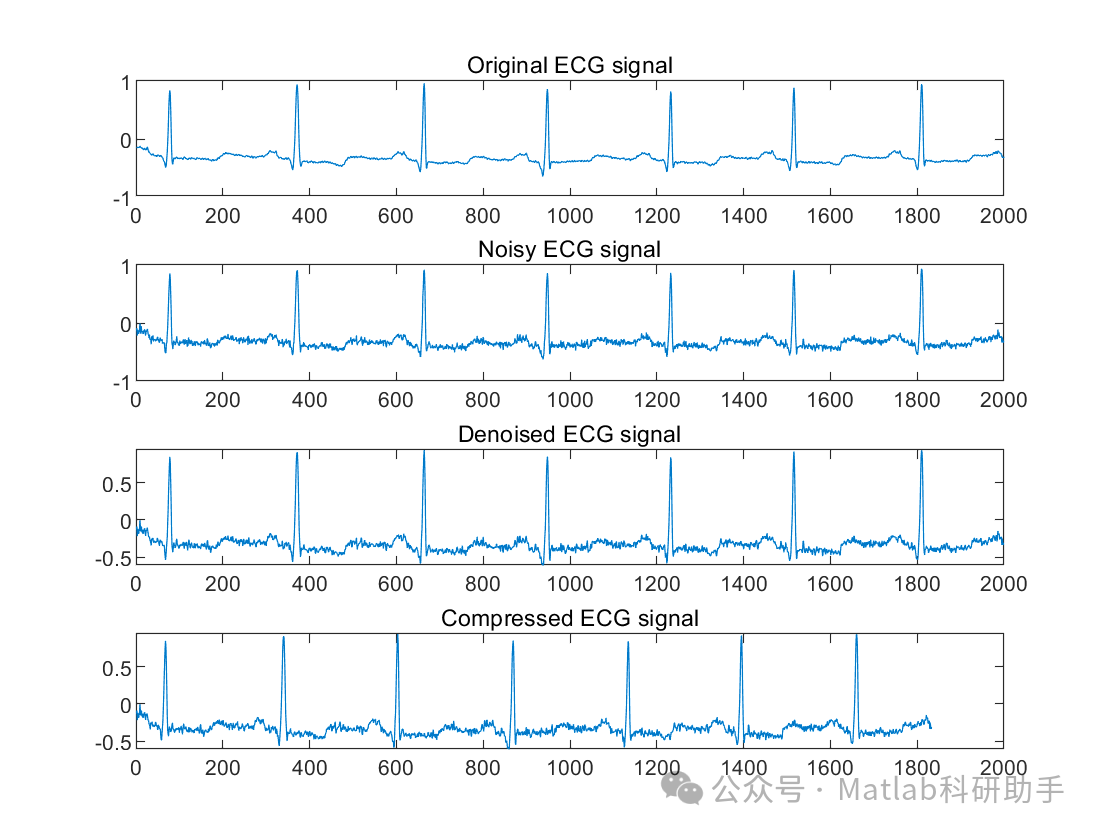 【心电图信号压缩】ECG信号压缩与通过三次样条近似重建的ECG信号压缩研究附Matlab代码-CSDN博客