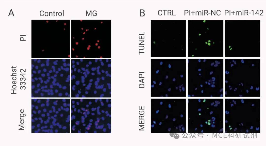 细胞凋亡检测方法有哪些？常用的细胞凋亡检测实验步骤 | MCE_癌细胞凋亡率研究方法-CSDN博客