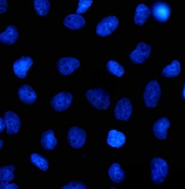 AbMole| 荧光染料的详细讲解_bodipy荧光染料原理-CSDN博客