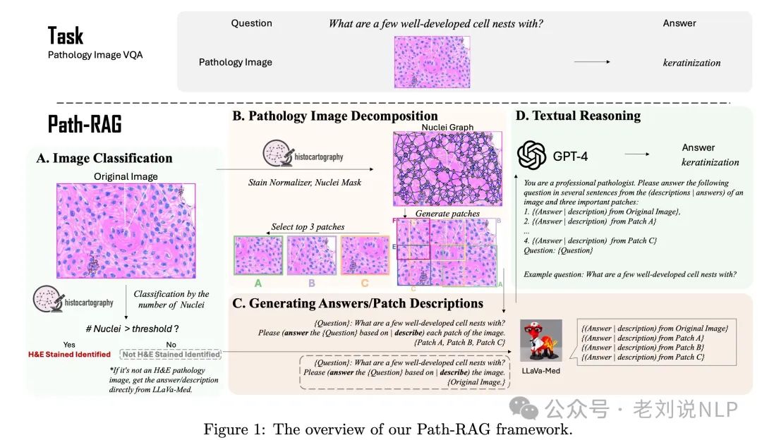 多模态RAG方案之V-RAG多文档问答及Path-RAG病理分析实现思路_path-rag: knowledge-guided key region retrieval fo-CSDN博客