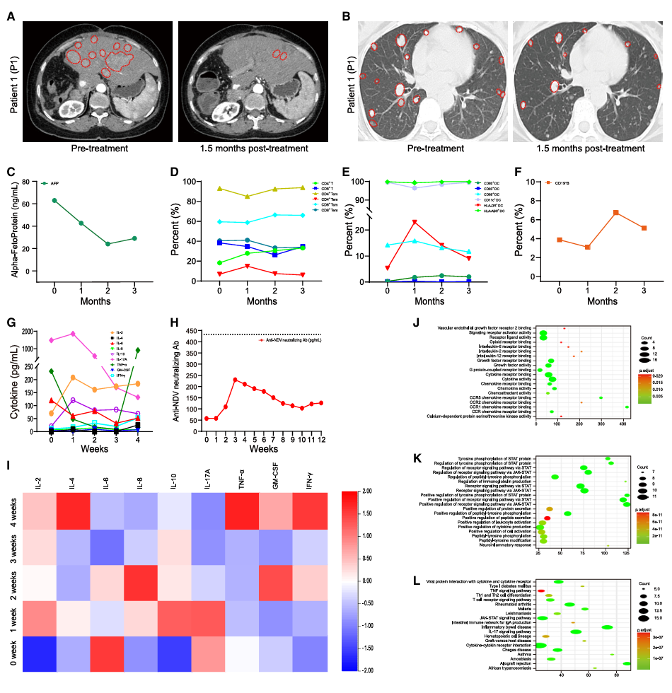25年《Cell》:NDV-GT实现90%实体肿瘤控制率_ndv-gt临床二期进展-CSDN博客
