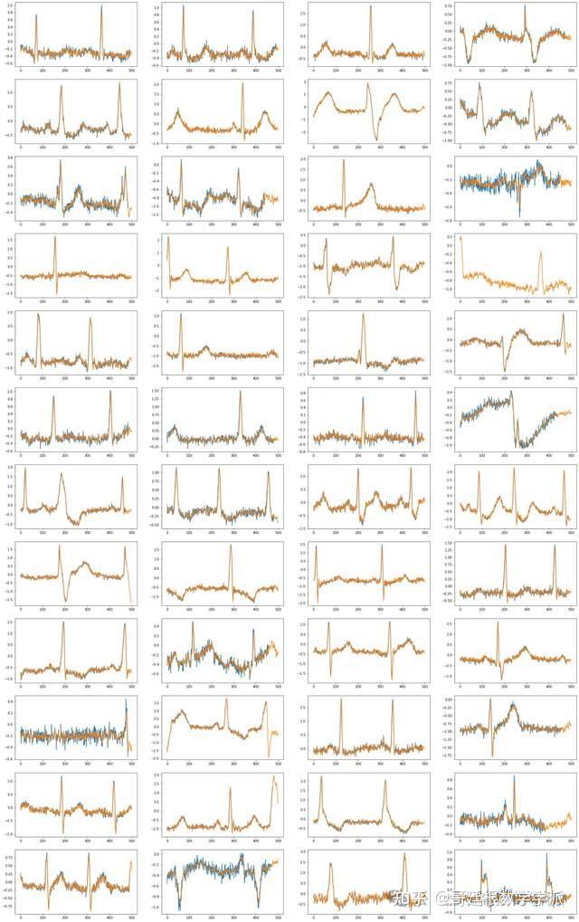 几种心电信号ECG降噪方法（Python）_ecg信号滤除50hz的python代码-CSDN博客