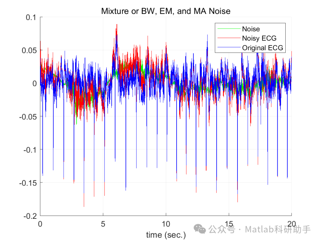 ECG信号处理——包括基本波检测、信号去噪、信号重建度量附Matlab代码_matlab ecg数据-CSDN博客