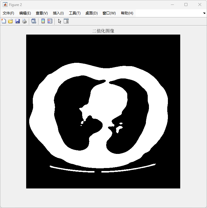 基于Matlab分水岭算法的医学DICOM图像肺结节检测与区域特性分析-CSDN博客