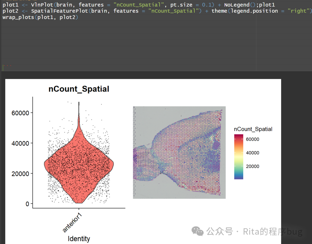debug|无法安装seurat v5,可以试试这个方法_seurat包安装不了-CSDN博客