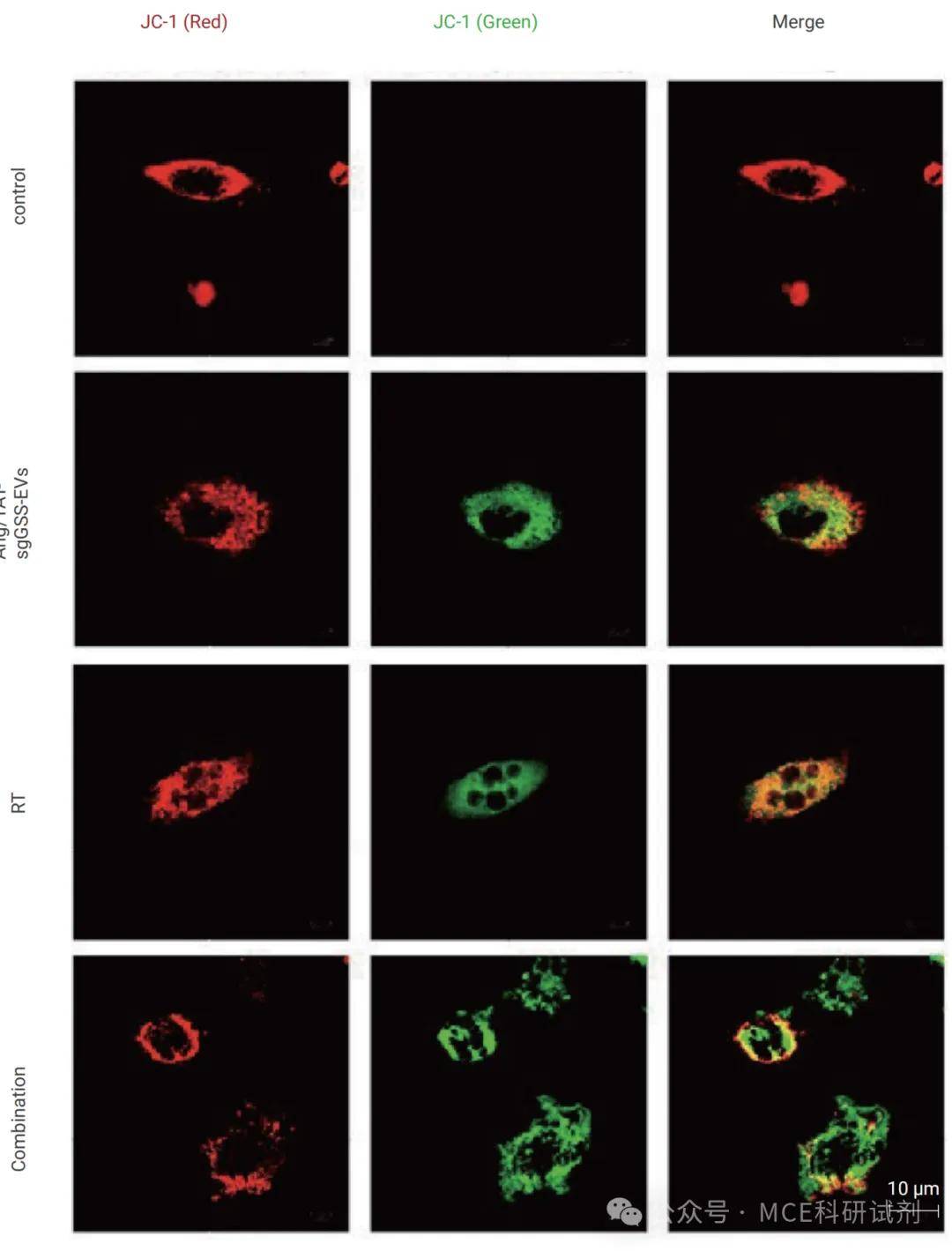 细胞凋亡检测方法有哪些？常用的细胞凋亡检测实验步骤 | MCE_癌细胞凋亡率研究方法-CSDN博客