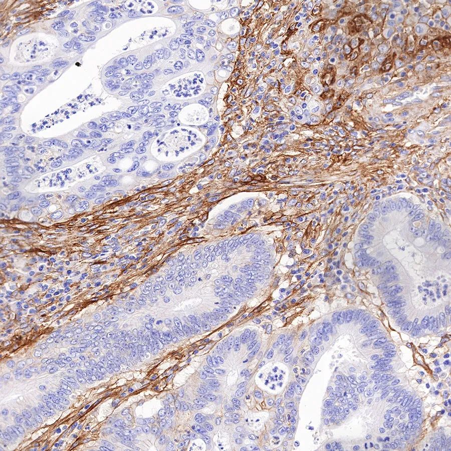 CDx 抗体 | 新兴靶点B7-H3/H4，助力ADC药物研发