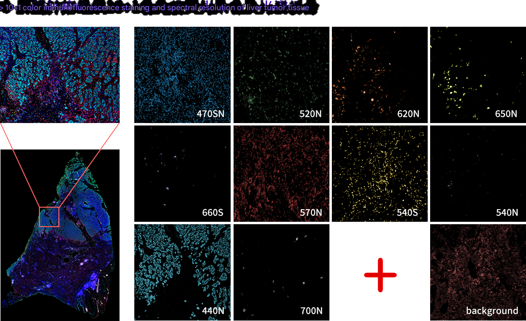 Albison panoramic multi-labeled tissue microenvironment staining ...