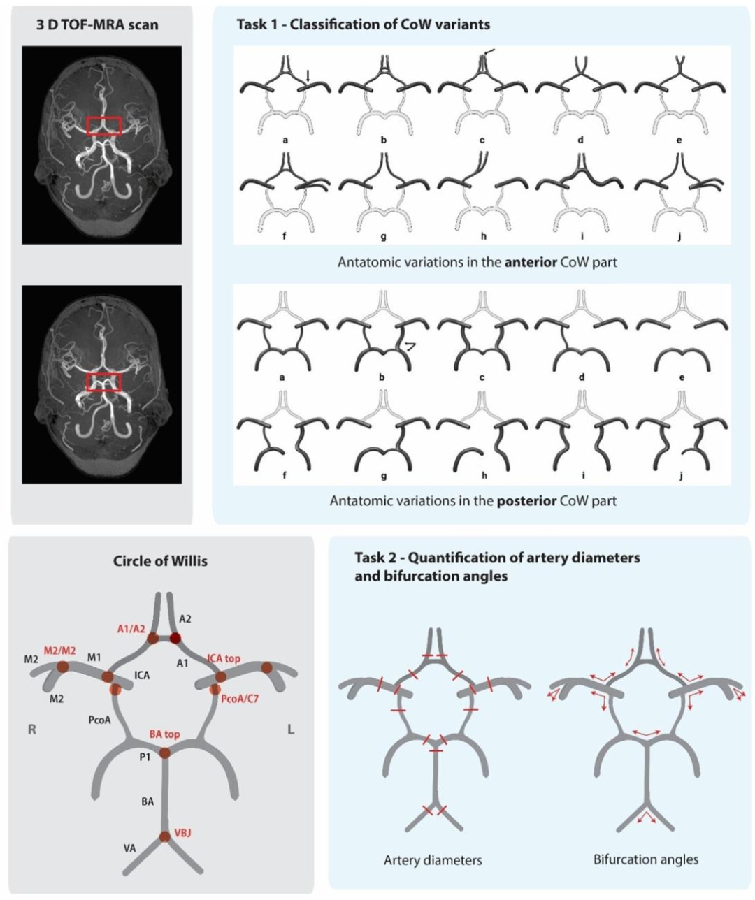Willis 环自动分类与动脉量化技术在 TOF-MRA 图像上的评估：CROWN 挑战|文献速递-医学影像算法文献分享_willis环mra ...