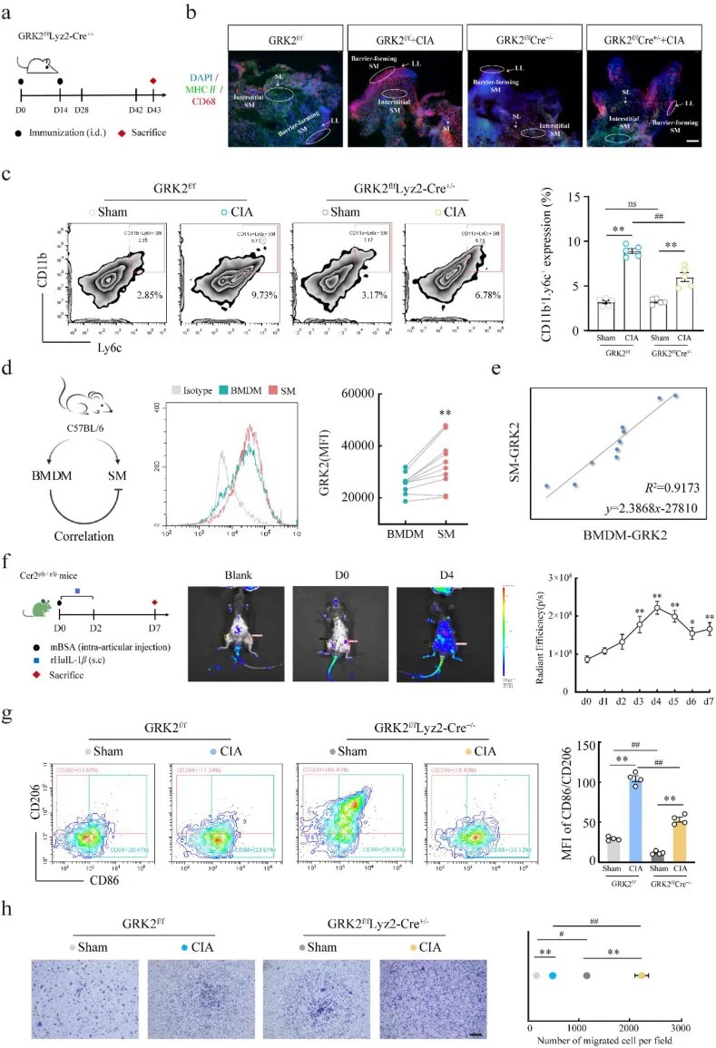 【备加速】LabEx多因子检测平台助力类风湿性关节炎研究-CSDN博客