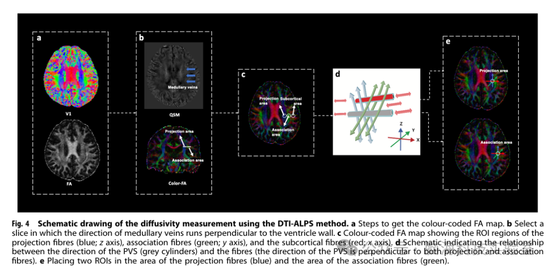 DTI-ALPS：一键揭秘脑类淋巴系统，助力神经疾病精准诊疗-CSDN博客