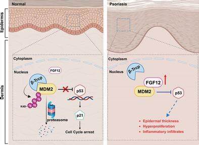 成纤维细胞生长因子12（FGF12）在肝脏纤维化中的作用及机制研究-CSDN博客