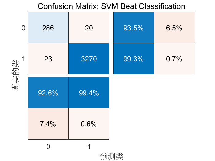 【心电信号ECG】基于支持向量机SVM心电图心搏检测与分类附Matlab复现含文献-CSDN博客