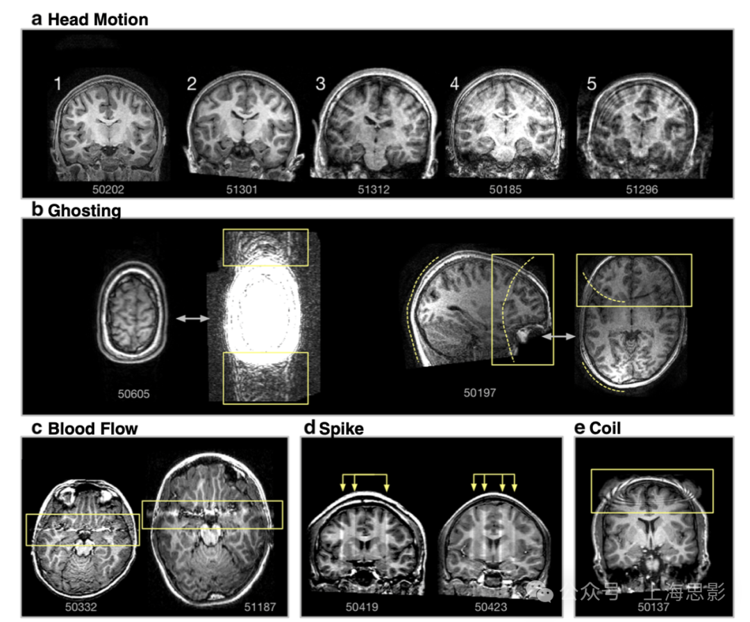 利用开放的神经影像数据集来理解大脑_ppmi数据集-CSDN博客