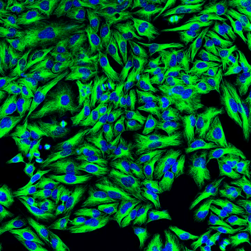 CVM中使用Cellpose-SAM进行高效细胞分割_cellpose 分割模型-CSDN博客