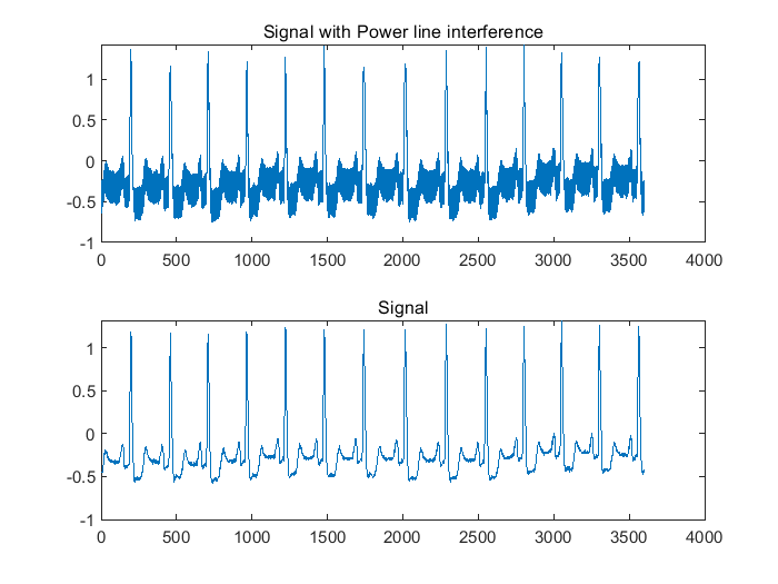 【心电信号ECG】基于粒子群算法PSO结合小波变换DWT实现心电图信号去噪附Matlab代码-CSDN博客
