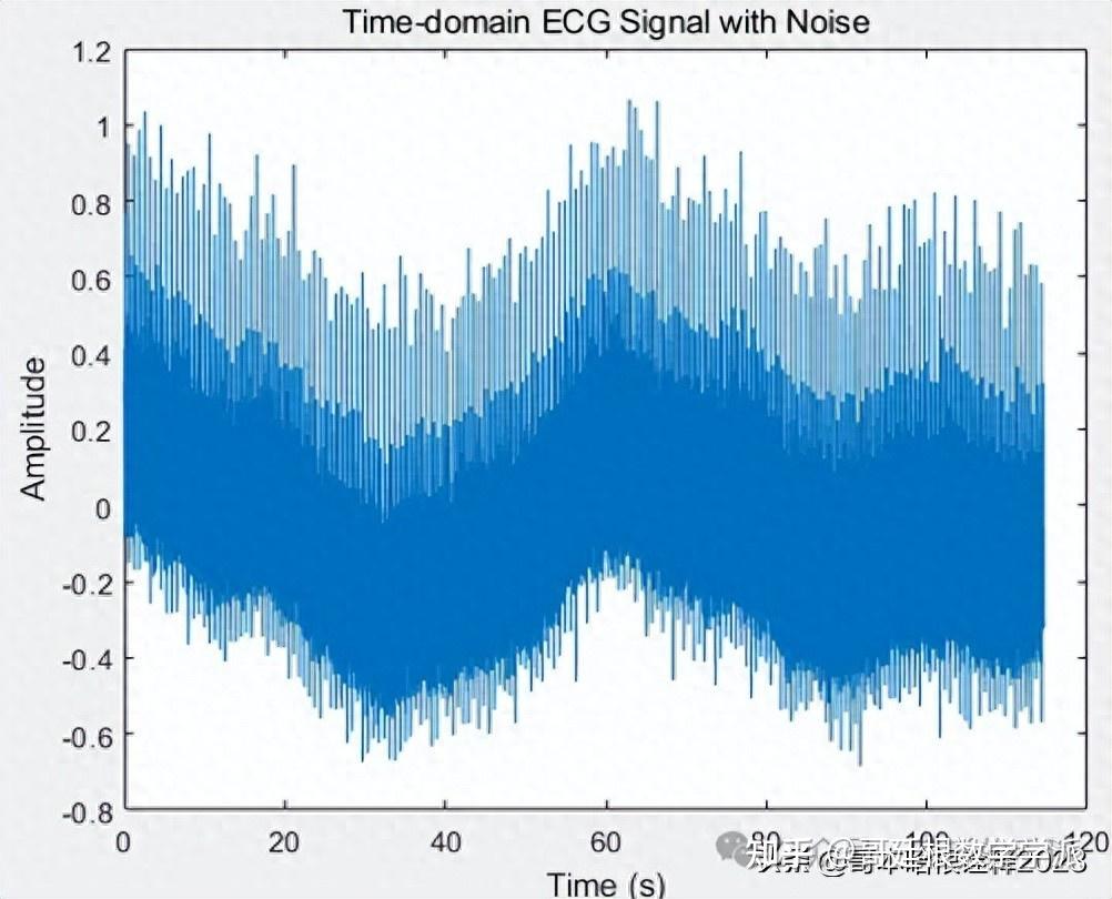 基于窗函数的FIR滤波器设计及信号降噪应用（MATLAB）_fir滤波器应用-CSDN博客