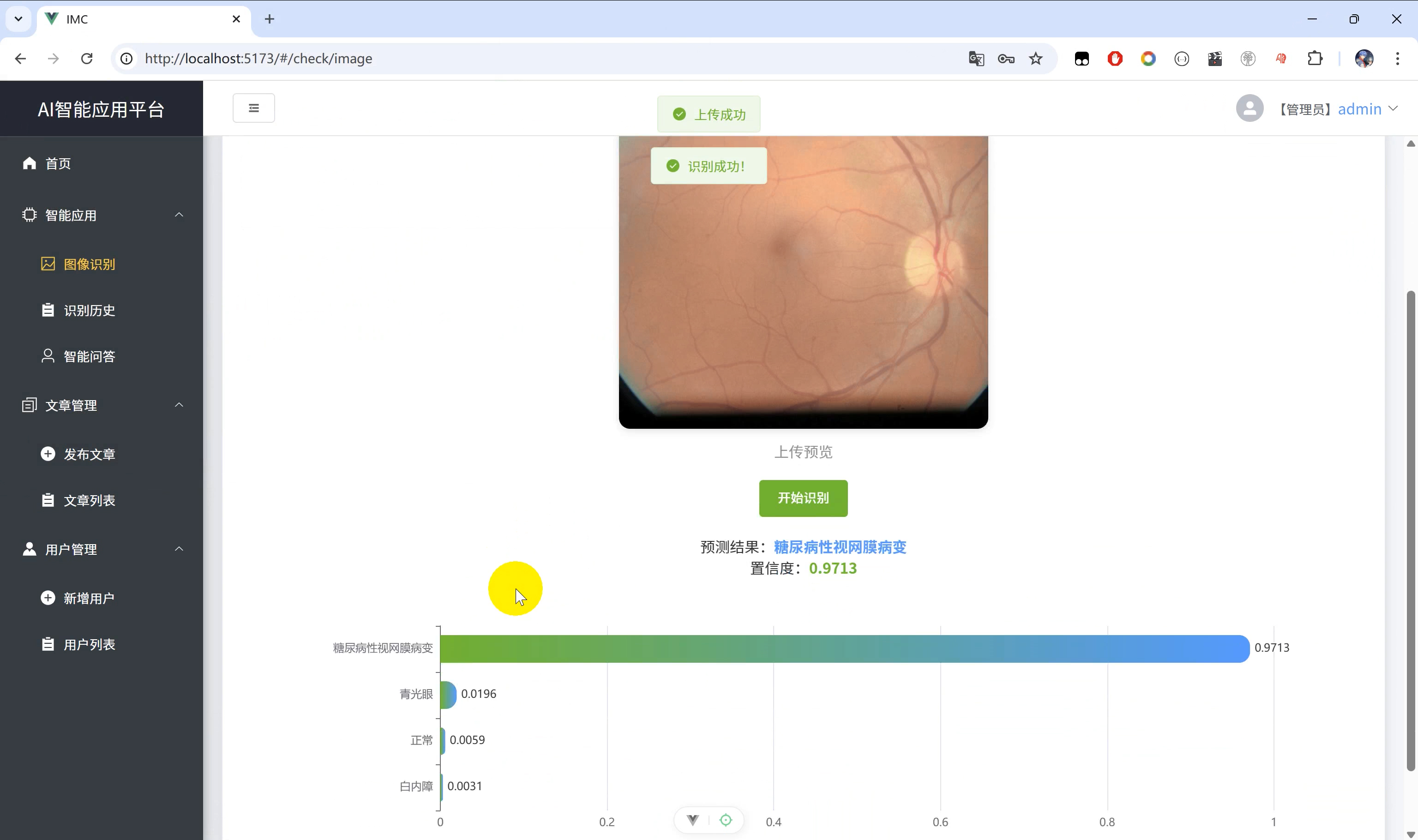 眼疾识别系统【最新版】Python+TensorFlow+Vue3+Django+人工智能+深度学习+卷积神经网络算法-CSDN博客