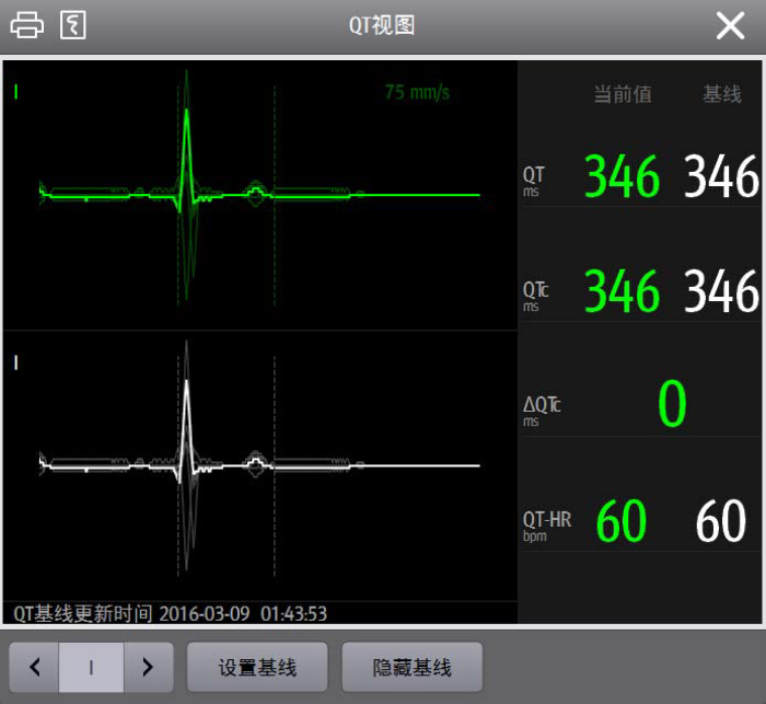 一文详解ECG心电波形之QT间期分析_qtcb和qtc-CSDN博客