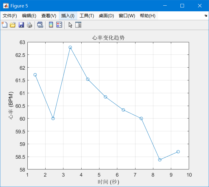 心电信号滤波QRS、心率检测Matlab程序(源码+lw+部署文档+讲解等)-CSDN博客