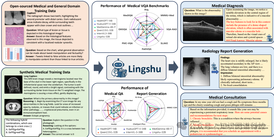 阿里巴巴震撼推出LingShu AI医生：统一多模态医学理解与推理的通用基础模型！_阿里灵枢大模型-CSDN博客