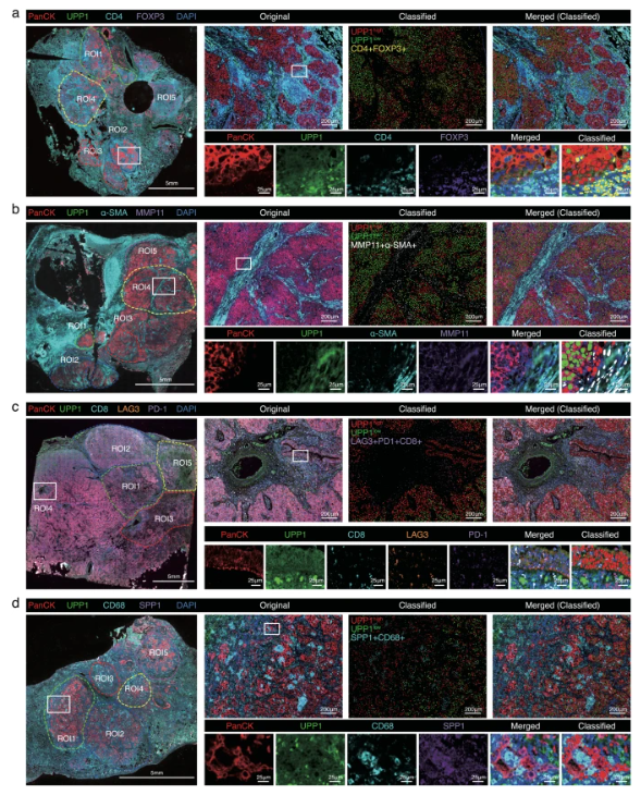 AbMole| 肺腺癌的新靶点：UPP1促进肿瘤进展的机制研究-CSDN博客