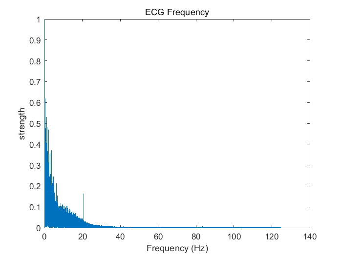 【心电信号ECG】心电图信号分析：分析心率和心律失常的心脏信号（含心率）附Matlab代码-CSDN博客