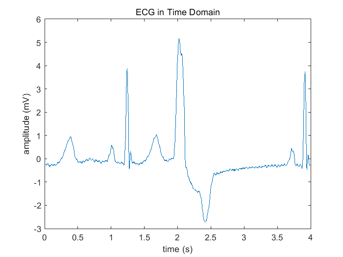 【心电信号ECG】心电图信号分析：分析心率和心律失常的心脏信号（含心率）附Matlab代码-CSDN博客