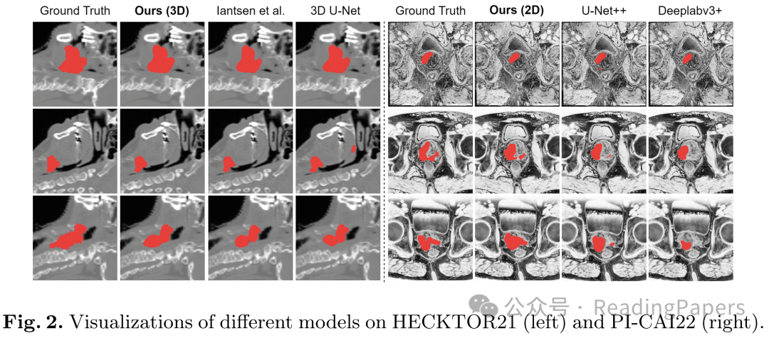 医图顶会 MICCAI‘23 | H-DenseFormer：多模态融合分割的高效混合密集连接Transformer_h-denseformer: an efficient hybrid ...