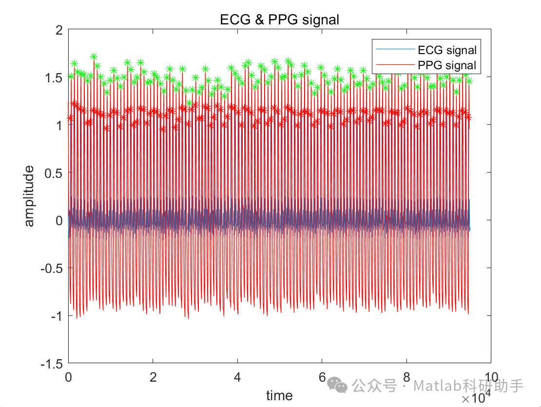 ECG和PPG信号用于PTT、HRV和PRV研究附Matlab代码-CSDN博客