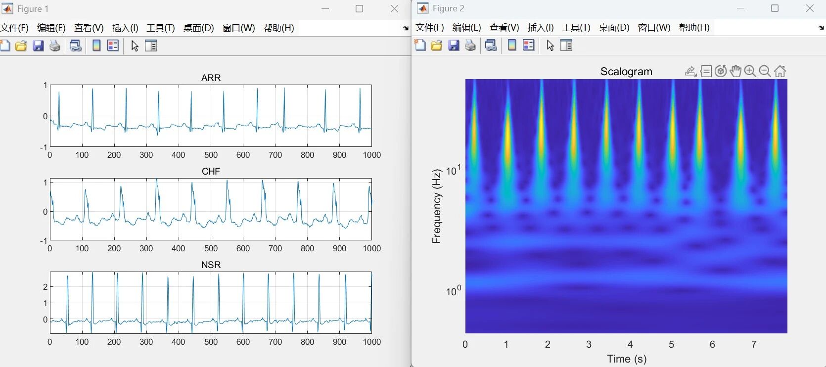 基于迁移学习（GoogLeNet和SqueezeNet）的ECG信号分类Matlab代码实现-CSDN博客